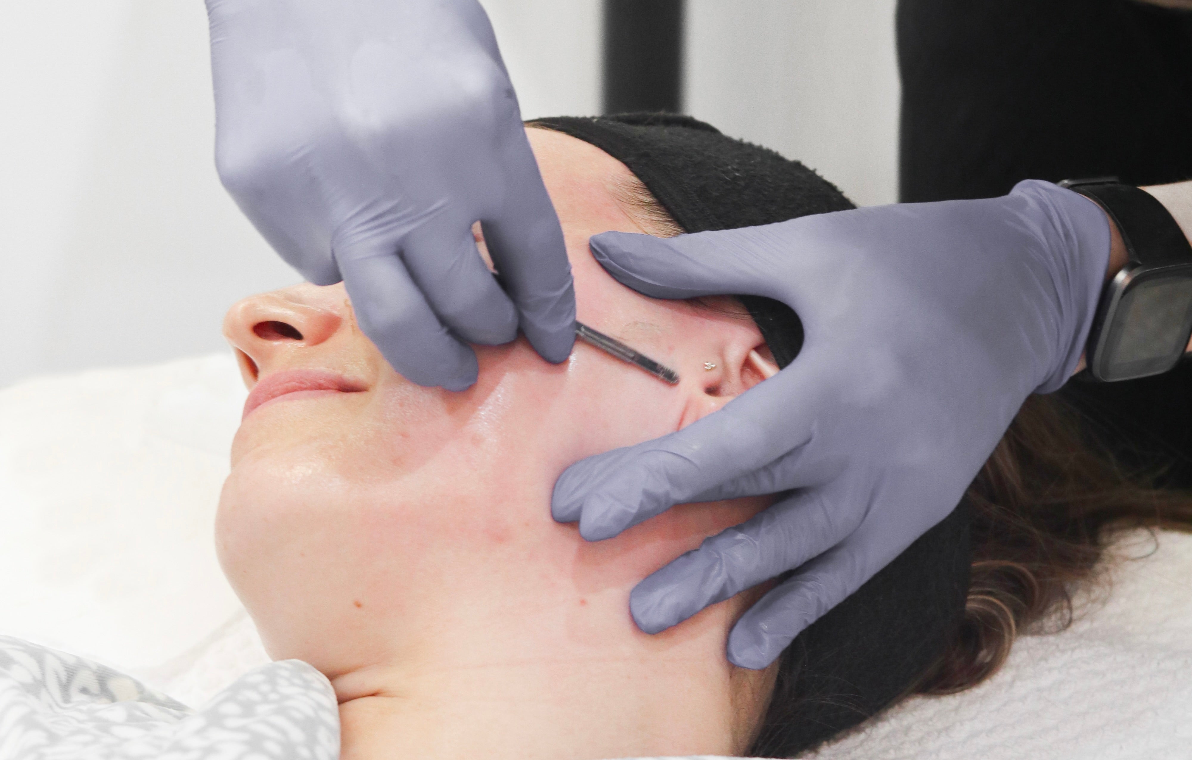 Elevating Professional Dermaplaning Services with the 10D Blade – Dermaplane Pro Canada